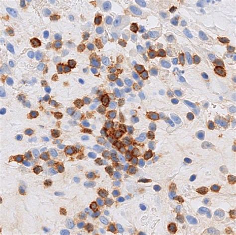 Cell Detection DAB Nuclei Not Visible Image Analysis Image Sc Forum