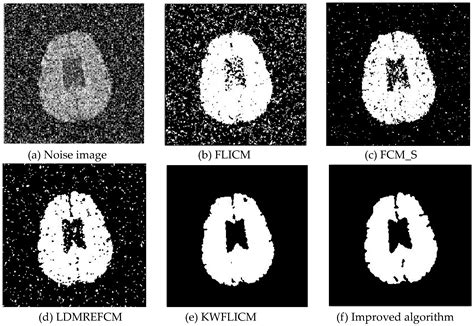 Sensors Free Full Text A Local Neighborhood Robust Fuzzy Clustering Image Segmentation