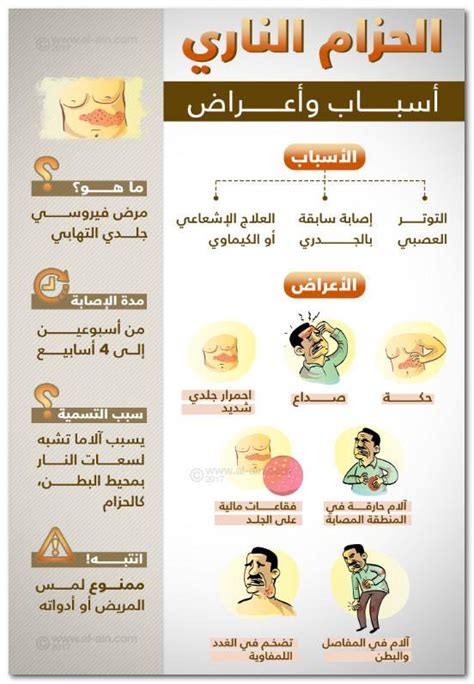 الحزام الناري عدوى كارثية فيروسية مؤلمة جدا يصاحبها ظهور فقعات مائية