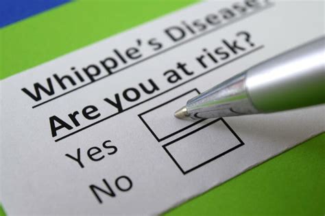 Meckels Diverticulum Symptoms Risks And Treatments Los Angeles Times