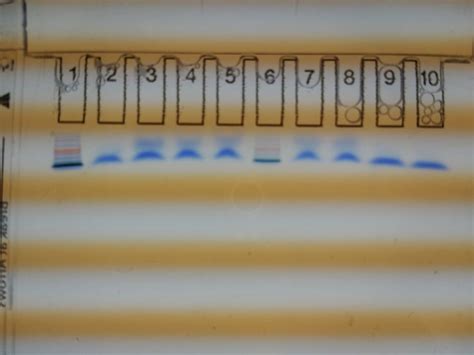 SDS PAGE Sample Not Stacking Well Multiple Dye Fronts Inverted Smiling On Bands