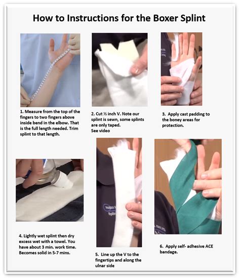 Ulnar Gutter Splint Pattern Pattern Matching Algorithms
