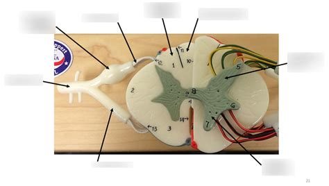 A P 1 Lab Spinal Cord Model 3 Flashcard Set Flashcards Quizlet