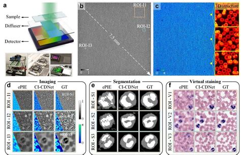 The Results Of Lensless Coded Ptychography A Is The Lensless On Chip
