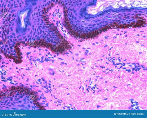 Histology Of Skin Collagen Royalty Free Stock Image