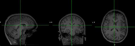 Fmriprep Error No Functional Output Folder Software Support