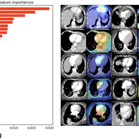 Interpretation Of The Model Predictions For The Image And Ehr Download Scientific Diagram