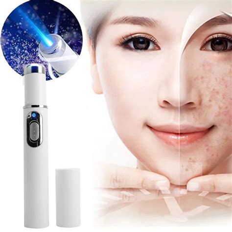 여드름 주름 제거 레이저 펜 피부 반점 제거 정맥류 방지 거미 정맥 지우개 치료 휴대용 의료용 블루 라이트 테라피