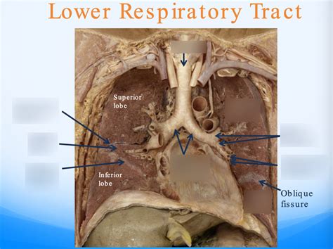 Lower Respiratory Tract Diagram Quizlet Lower Respiratory Tract Diagram Quizlet