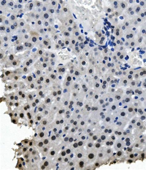 Rna Helicase A Dhx9 Antibody