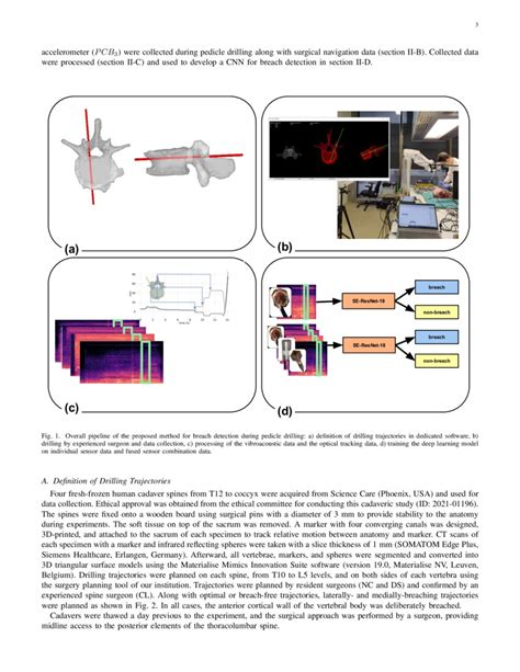 Automatic Breach Detection During Spine Pedicle Drilling Based On Vibroacoustic Sensing Deepai