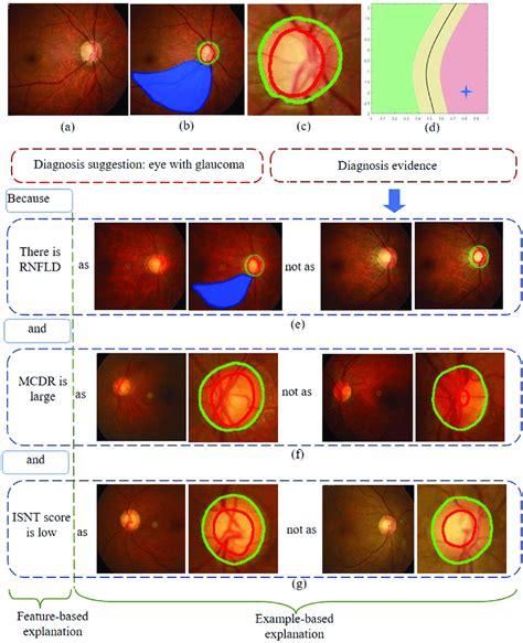 schematic of transparency and interpretability for hierarchical deep