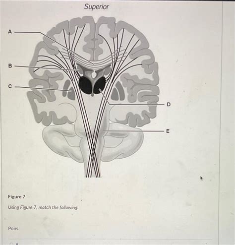 Figure 7 Using Figure 7 Match The Following