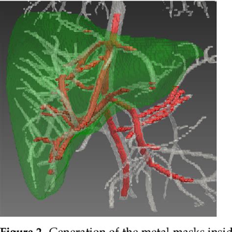 Figure 2 From End To End Deep Learning Ct Image Reconstruction For Metal Artifact Reduction