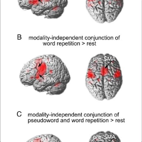 Pdf Increased Facilitatory Connectivity From The Pre Sma To The Left