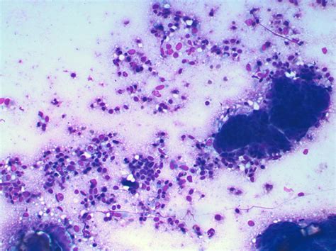 Eurocytology