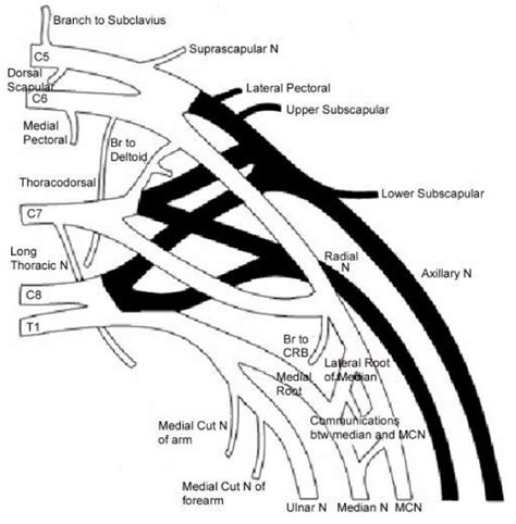 Schematic Diagram Of The Brachial Plexus Of The Right Side Of 57 Year