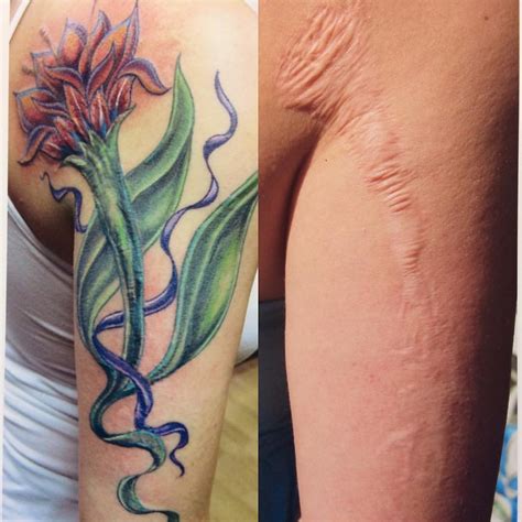 Can You Cover Scars With Tattoos Complete Guide 30 Pics Artistic