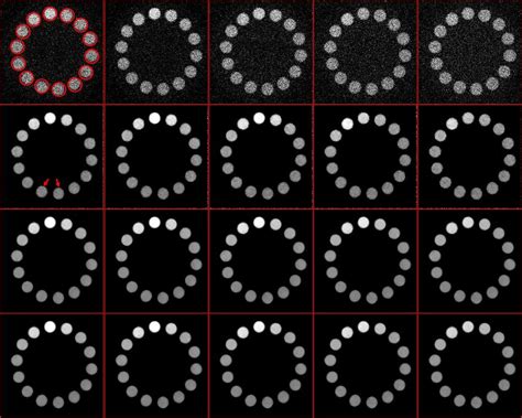 The Reconstruction Results Of Case 6 The 1 St 4 Th Rows Fbp Results