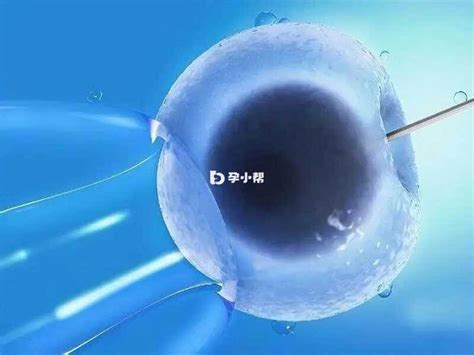 试管黄体期方案成功率 黄体期促排方案费用介绍 孕小帮