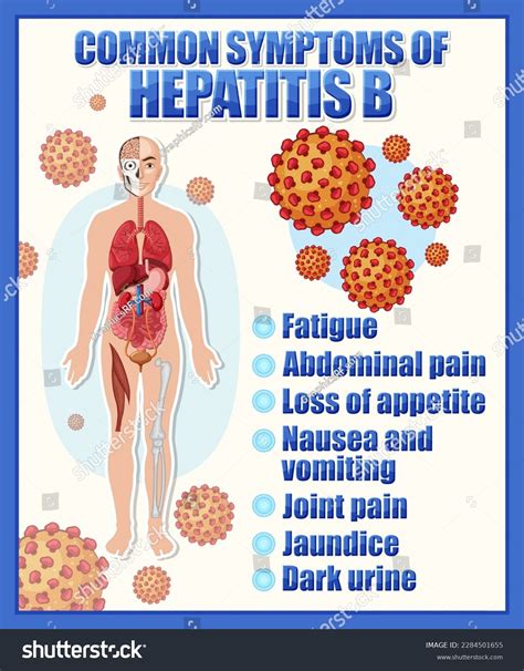 Informative Poster Common Symptoms Hepatitis B Stock Vector Royalty Free 2284501655 Shutterstock
