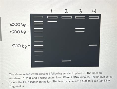 the above results were obtained following gel