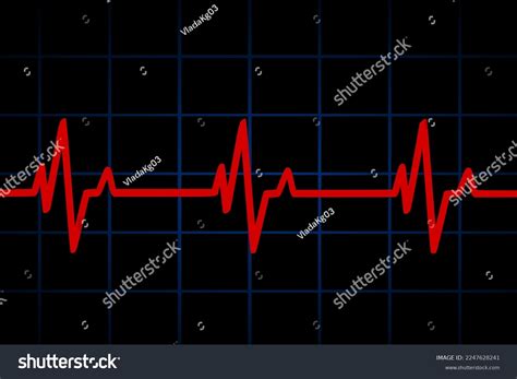 Vector Illustration Heart Rate Pulse Graph Stock Vector Royalty Free 2247628241 Shutterstock
