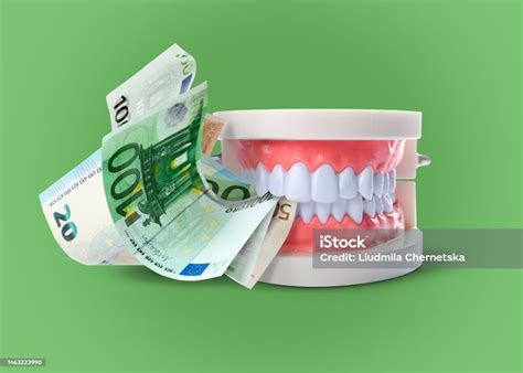 녹색 배경에 치아와 유로 지폐가 있는 구강 모델 비싼 치과 시술의 개념 0명에 대한 스톡 사진 및 기타 이미지 0명 가격 개념 Istock