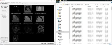 Itk Snap医学图像标注方法（超级详细）——保姆级学习curb Gitcode 开源社区
