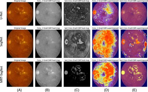 The Performance Of Different Models Such As U‐net Segnet Mrt‐segnet