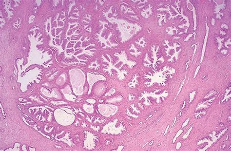 Histopatología Junio 2014