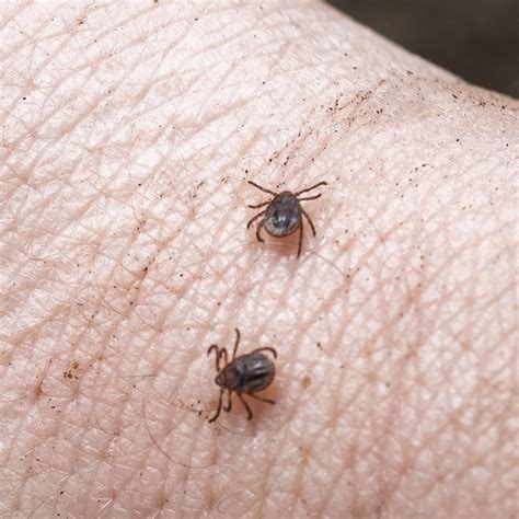 Ticks King County Washington