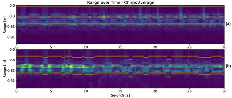 Few Shot User Adaptable Radar Based Breath Signal Sensing
