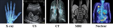 Different Medical Imaging Modalities Download Scientific Diagram