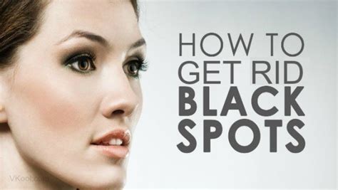 Ways On How To Get Rid Of Black Spots On Face Naturally
