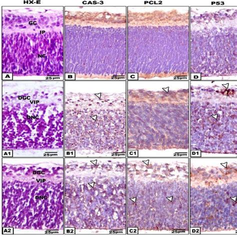 Formalin Fixed Histological And Immunochemical Staining Of Section Of
