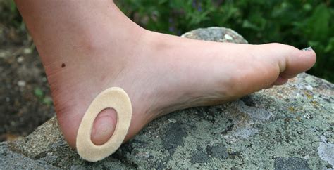 Blister Treatment Sportsmd
