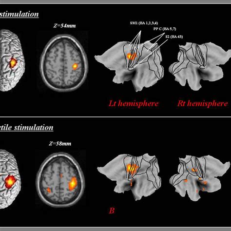 Significant Brain Activation Area Between Visuo Tactile And Tactile