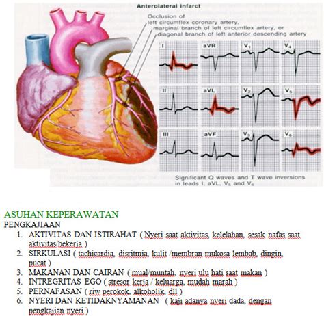 Asuhan Keperawatan Arteriosklerosis My Documentku