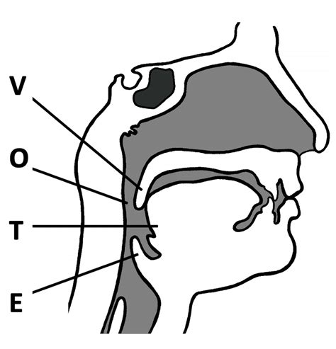 Corresponding Positions Of The Vote Classification In The Upper Airway Download Scientific