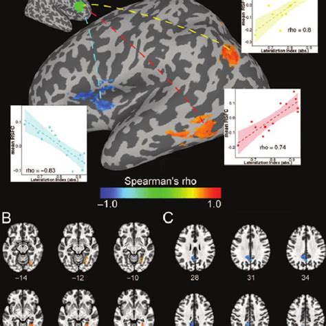Relationships Between Language Lateralization Index And Several Download Scientific Diagram