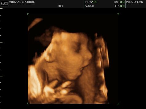 19 седмица от бременността какво се случва с бебето 18 снимки развитието на плода и