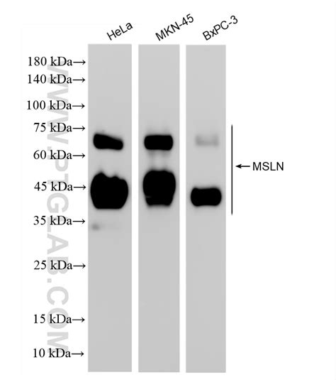 Mesothelin Antibody 83744 6 Rr Proteintech