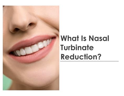 What Is Nasal Turbinate Reduction Pdf