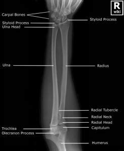 Radiographic Anatomy Of The Forearm Artofit