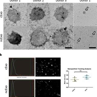 Electron Microscopy And Nanoparticle Tracking Analysis A Download Scientific Diagram