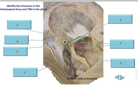 Temporomandibular Joint Tmj And Infratemporal Fossa Flashcards Quizlet