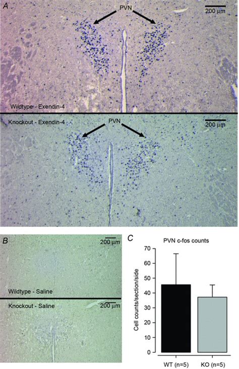 Neuronal C Fos Response To Ex 4 In The Hypothalamic Paraventricular Download Scientific Diagram
