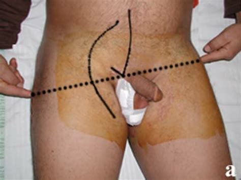 Appearance Of Patient On Physical Examination The Entrance And Exit Download Scientific