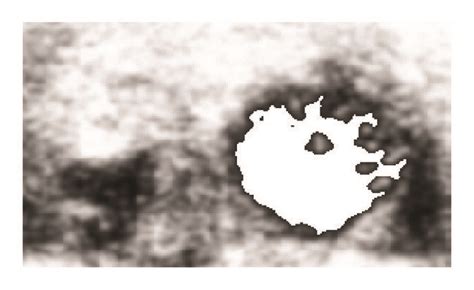 Segmented Area Using Region Growing Download Scientific Diagram